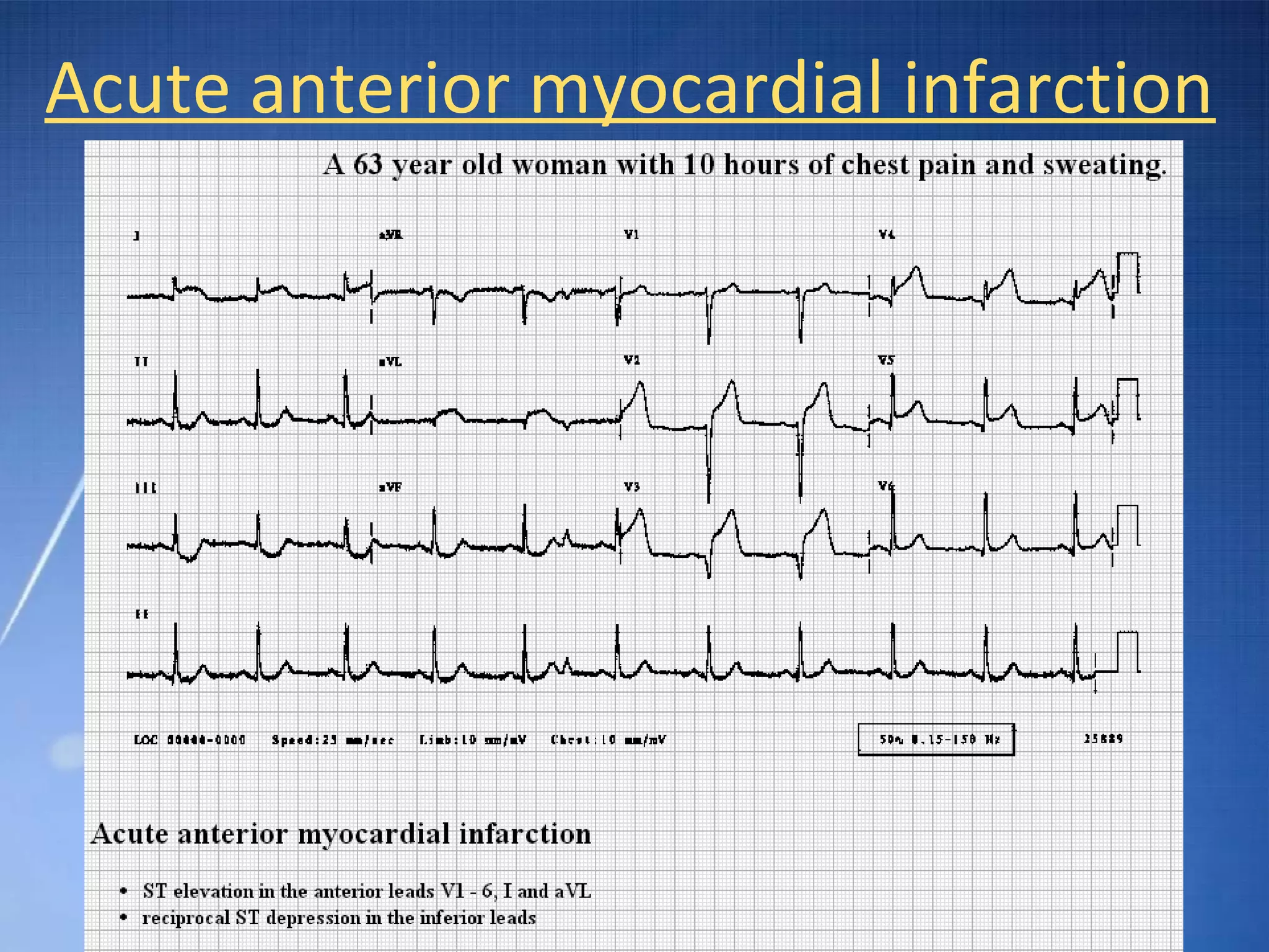 Ecg Basic Guidelines Ppt