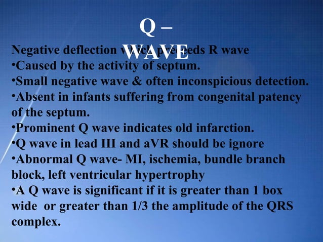 Ecg Basic Guidelines Ppt