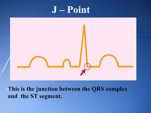 Ecg basic guidelines | PPT