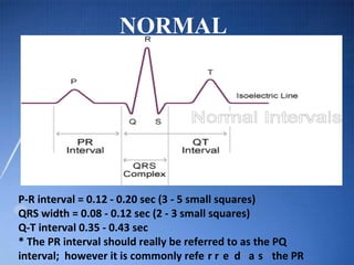 Ecg basic guidelines | PPT