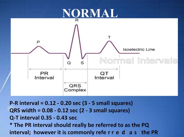 Ecg basic guidelines | PPT