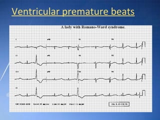 Ecg basic guidelines | PPT