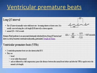 Ecg basic guidelines | PPT
