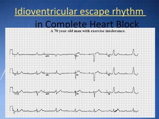Ecg basic guidelines | PPT