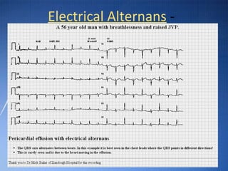 Ecg basic guidelines | PPT