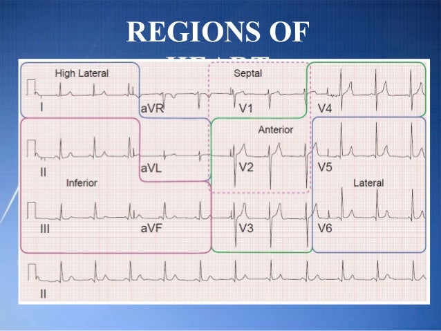 Ecg basic guidelines