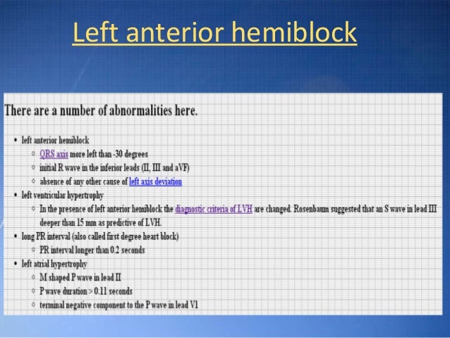Ecg basic guidelines