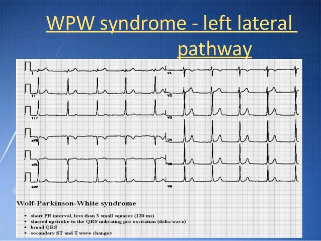Ecg basic guidelines