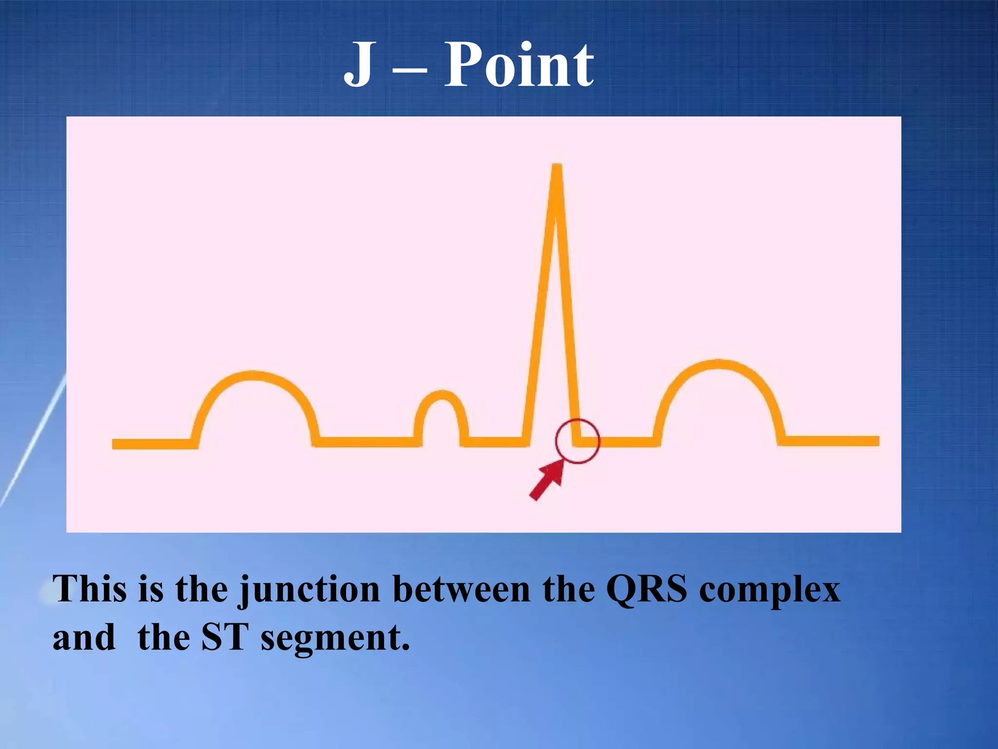 Ecg basic guidelines | PPT