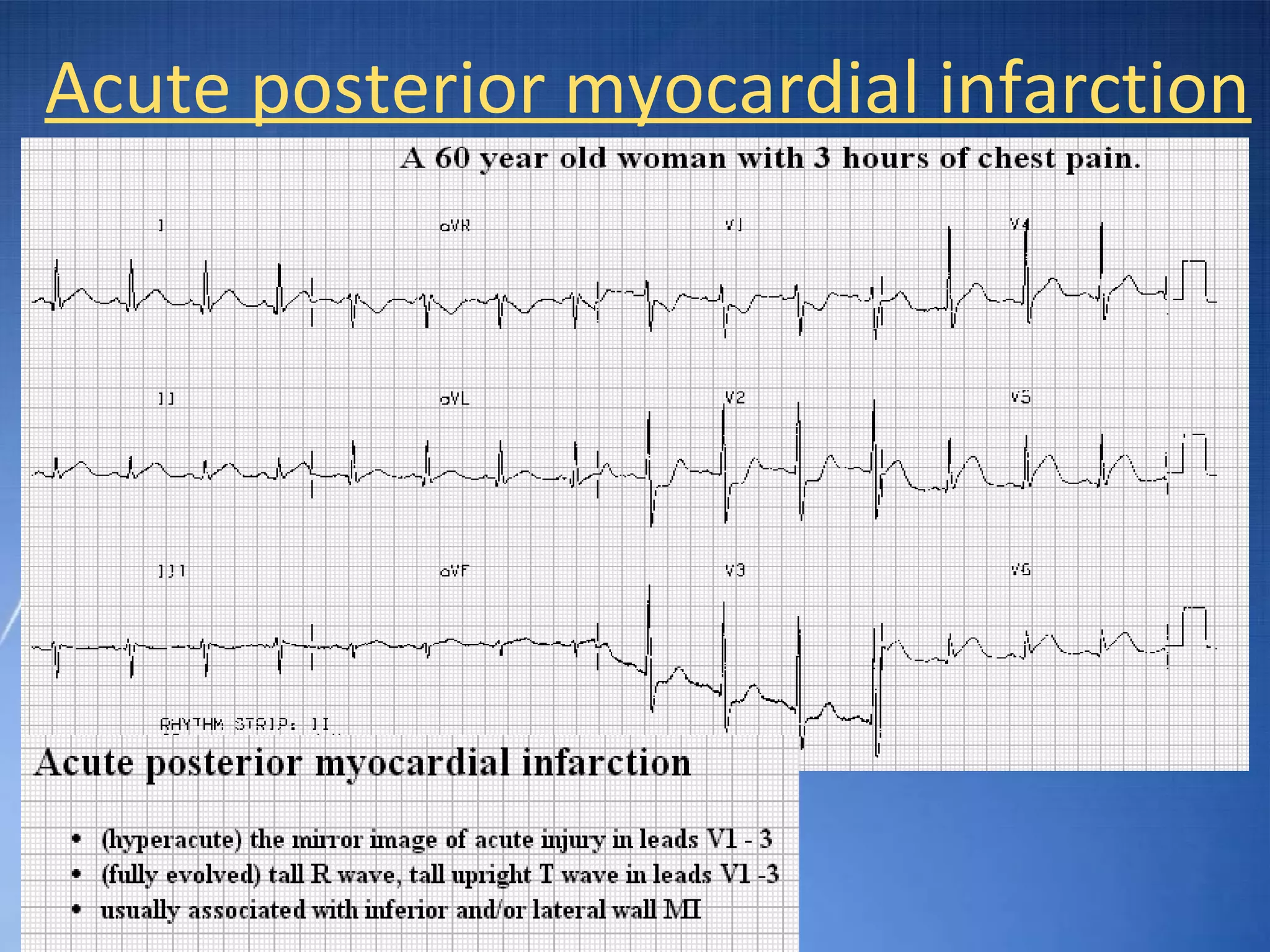 Ecg basic guidelines | PPT