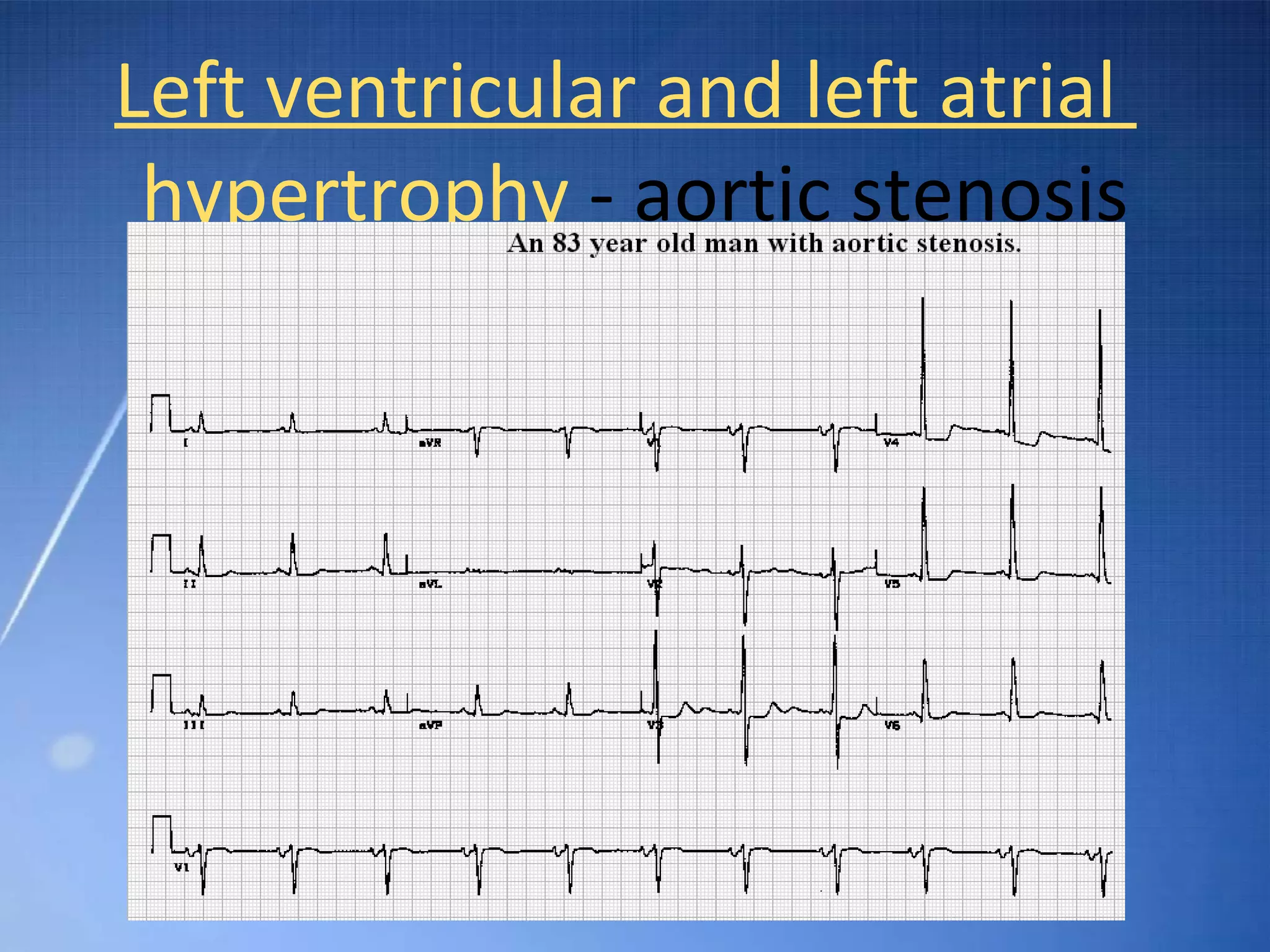 Ecg basic guidelines | PPT