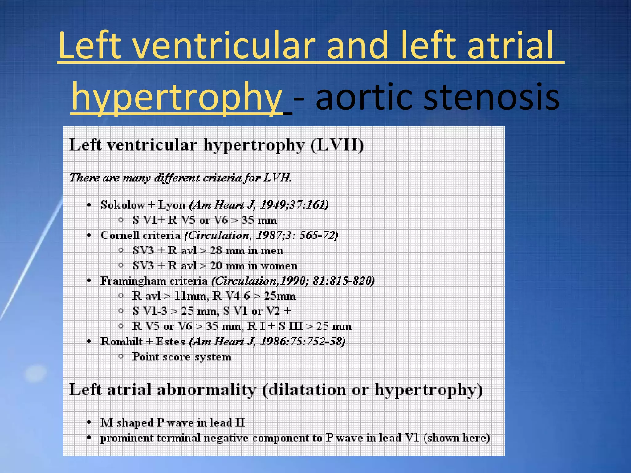 Ecg basic guidelines | PPT
