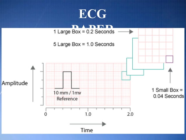 Ecg basic guidelines | PPT