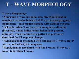 Ecg basic guidelines | PPT