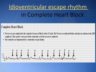 Ecg basic guidelines | PPT