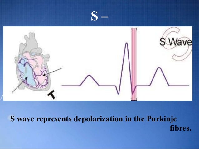 Ecg basic guidelines