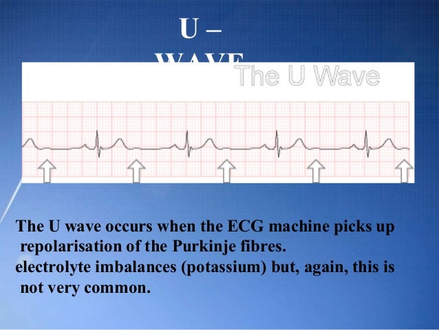 Ecg basic guidelines