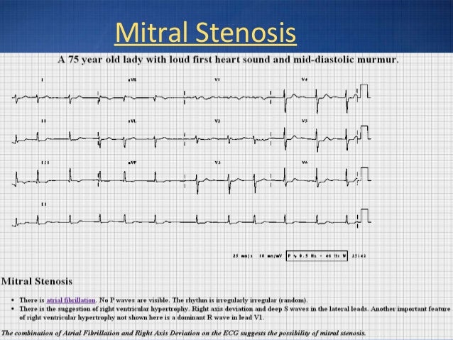 Ecg basic guidelines