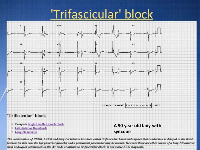 Ecg basic guidelines
