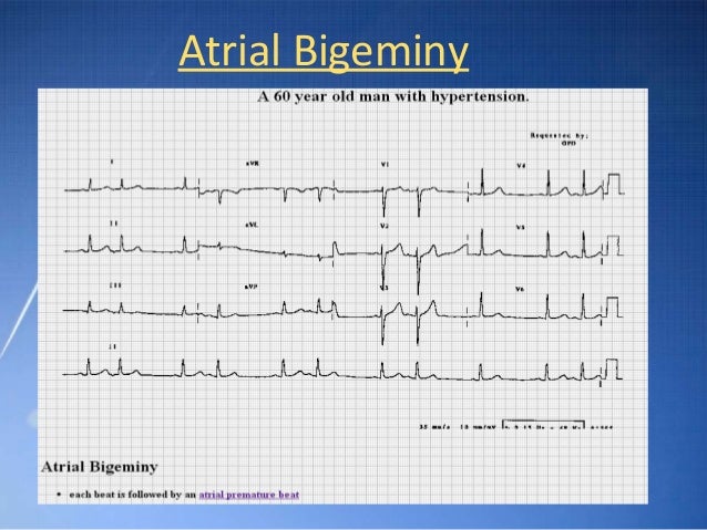 Ecg basic guidelines