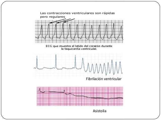 Intervalo pr electrocardiograma - harmonyinriko
