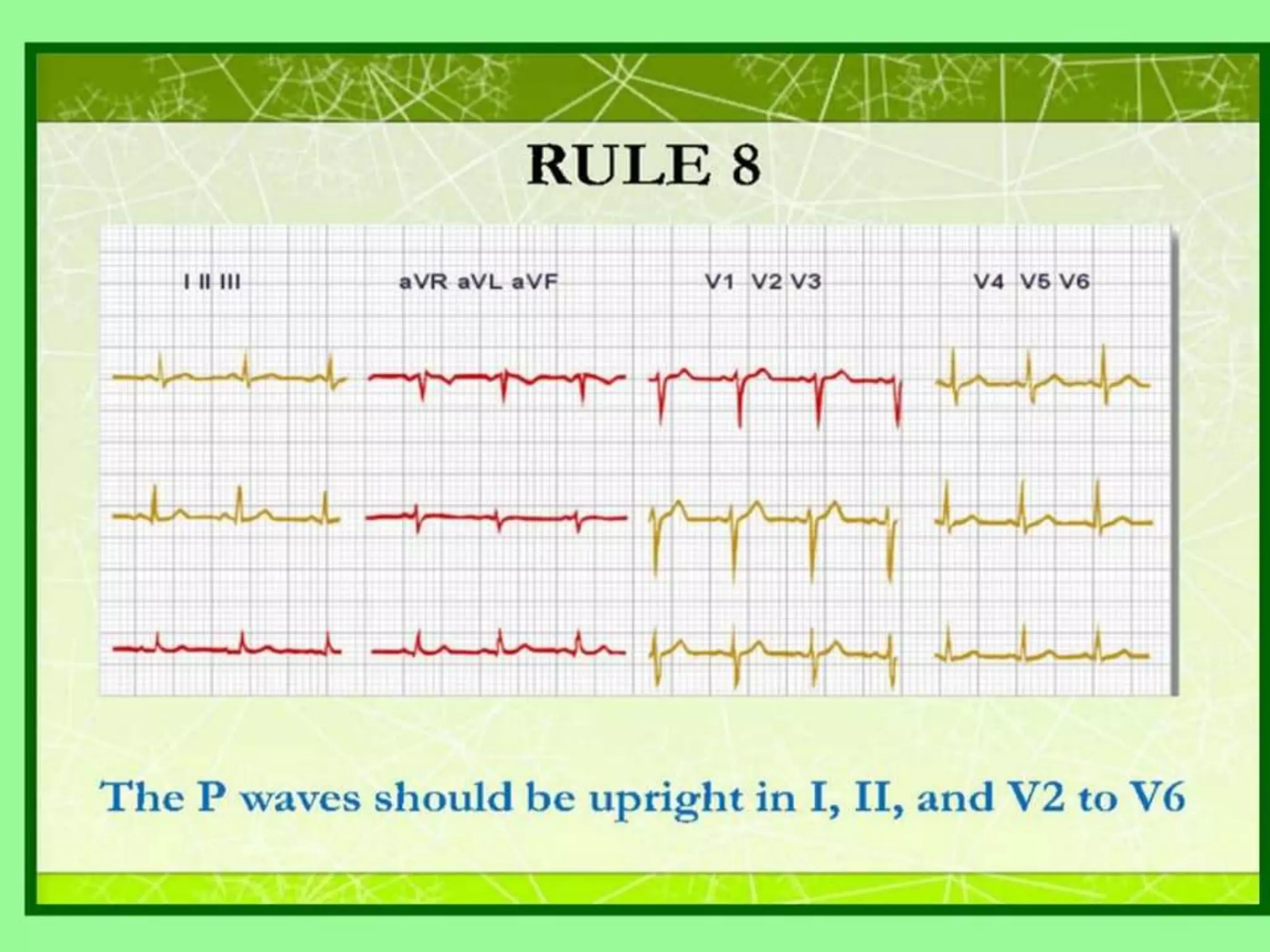 Ecg basic rules | PPT