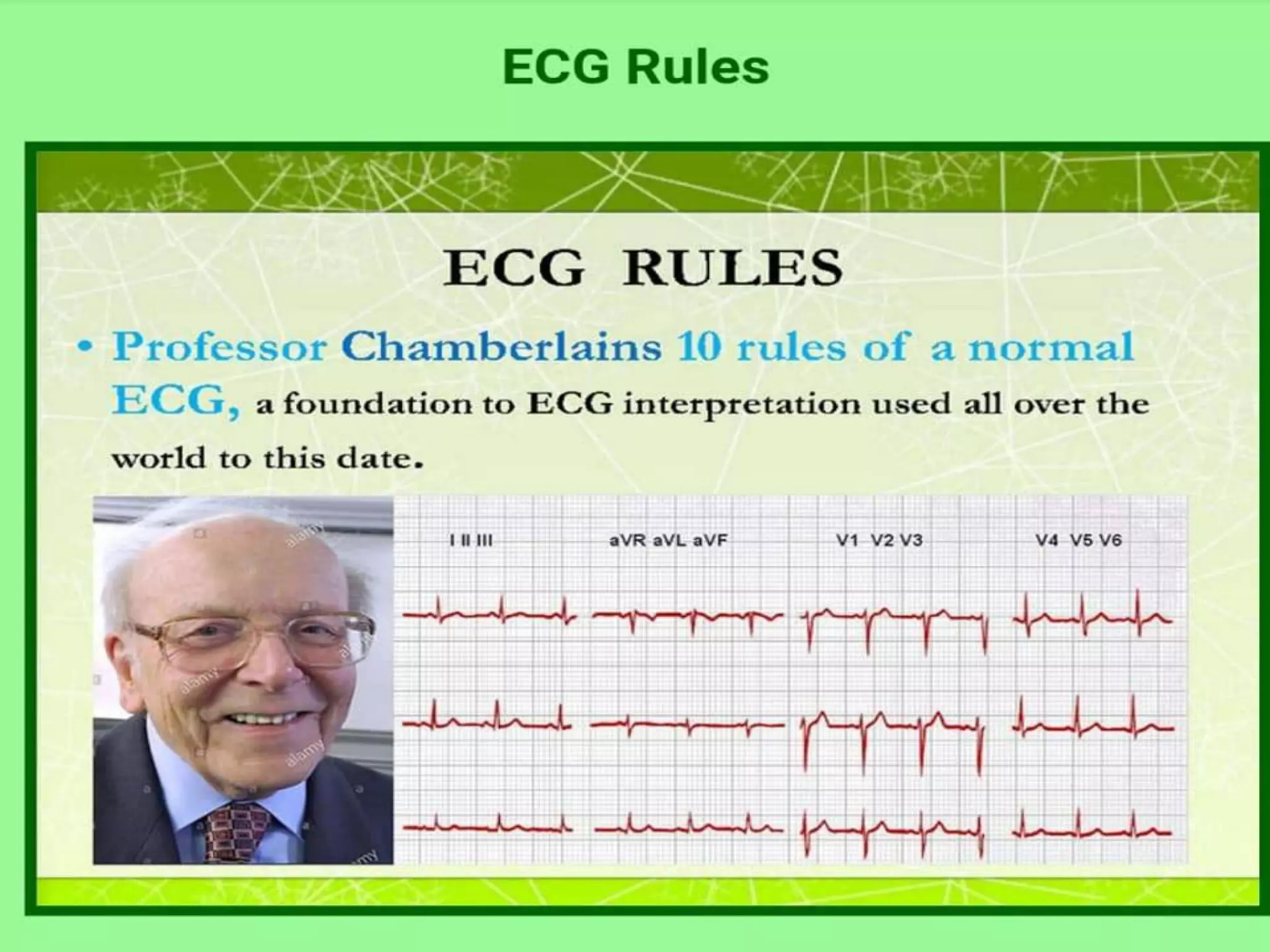 Ecg basic rules | PDF