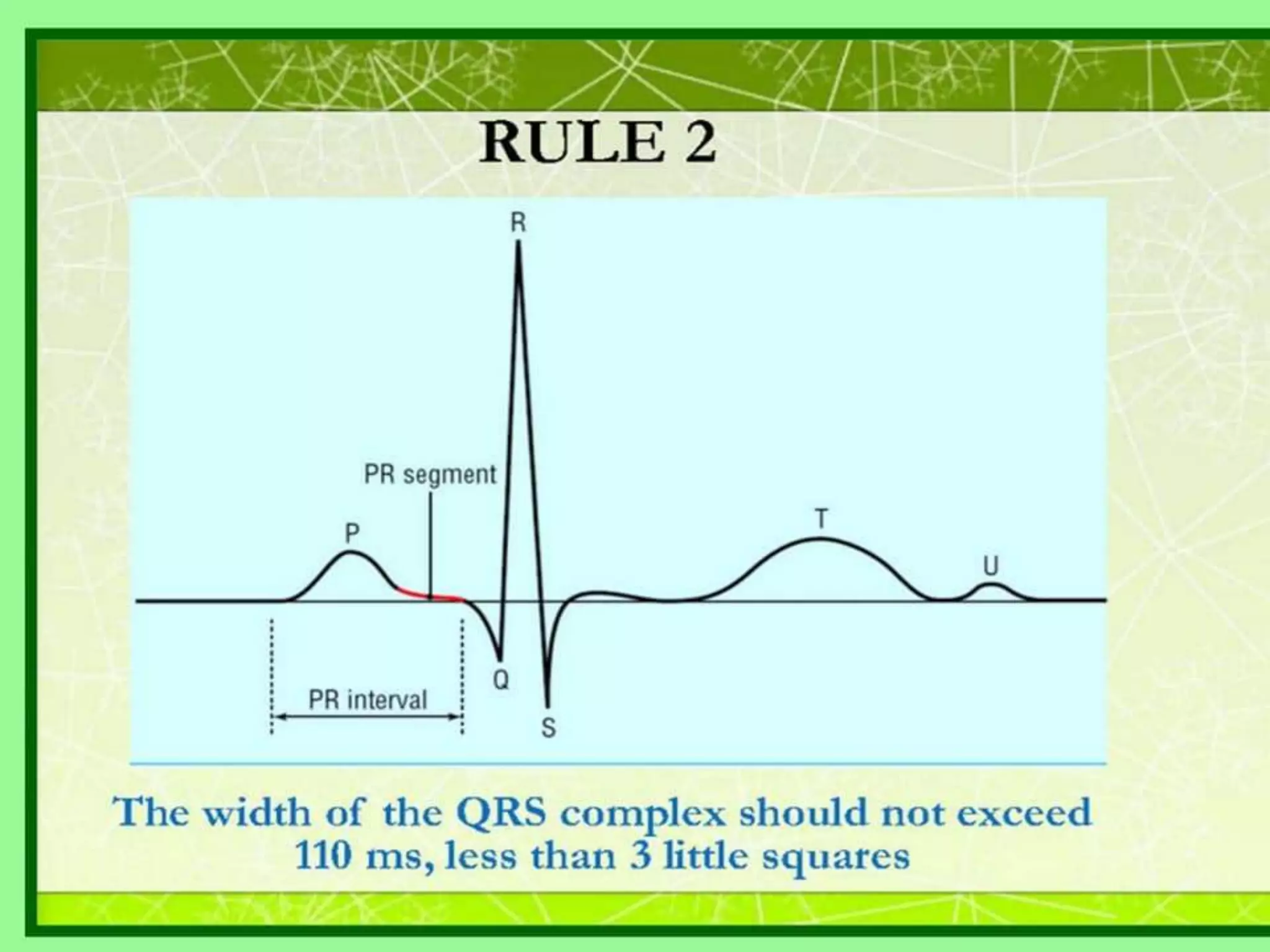 Ecg basic rules | PDF