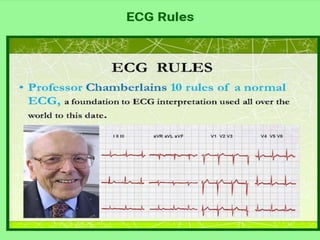 Ecg basic rules | PPT