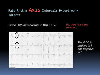 Ecg basics.ppts