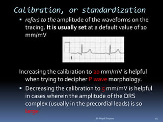 Ecg basics.ppts