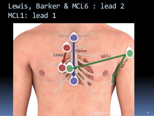 Ecg basics.ppts