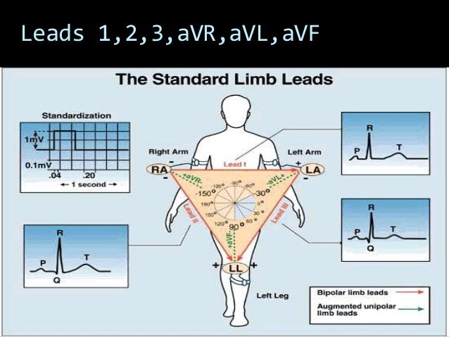 Ecg basics.ppts