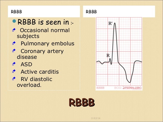 ECG Basics