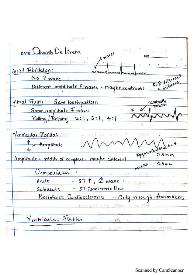 ECG Basics | PDF