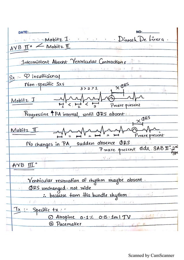 ECG Basics | PDF