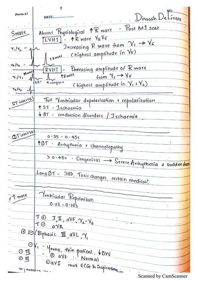 ECG Basics | PDF