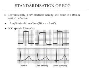 Ecg basics | PPT