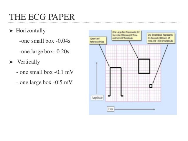 Ecg basics