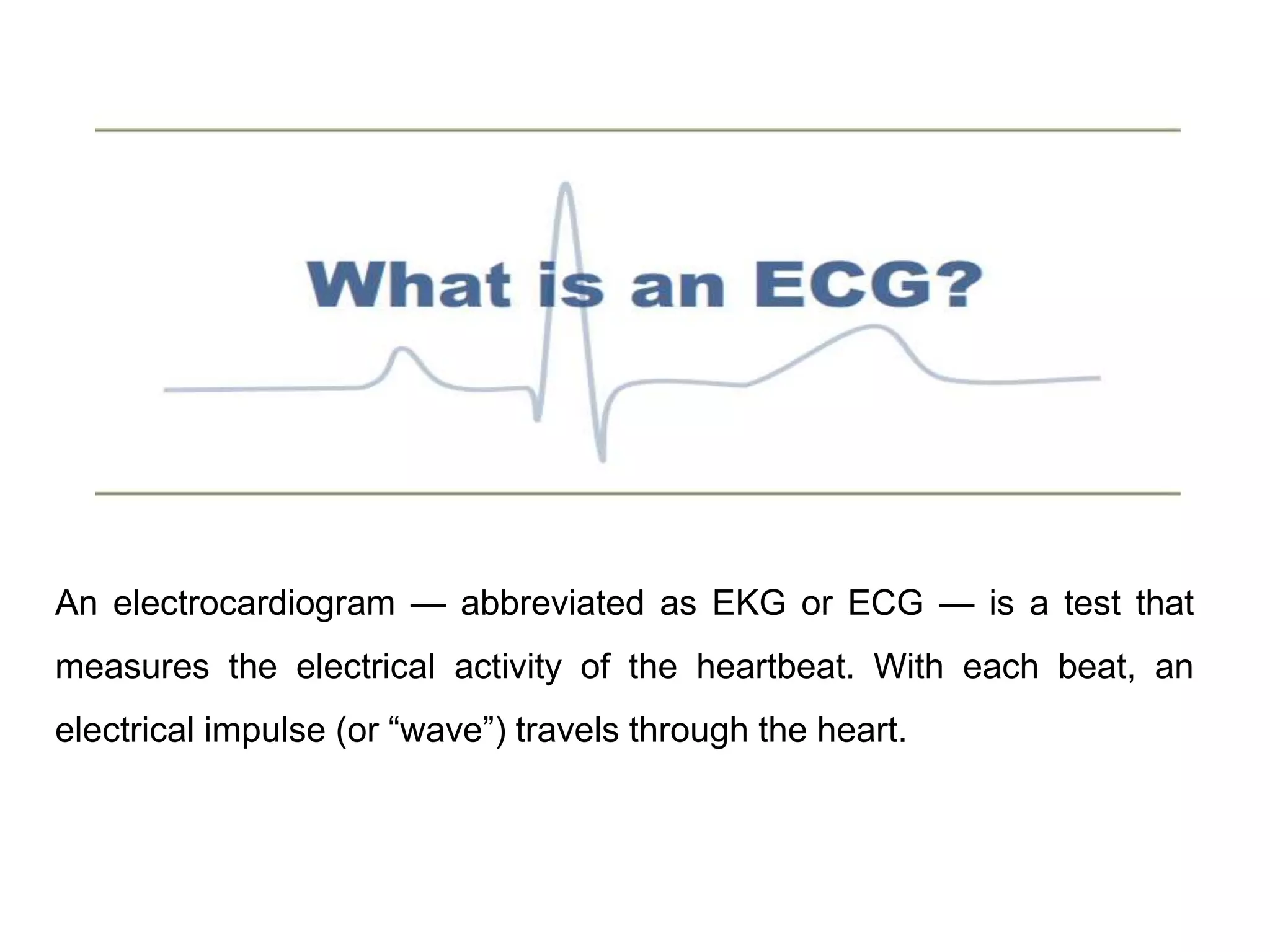 Ecg basics | PPT