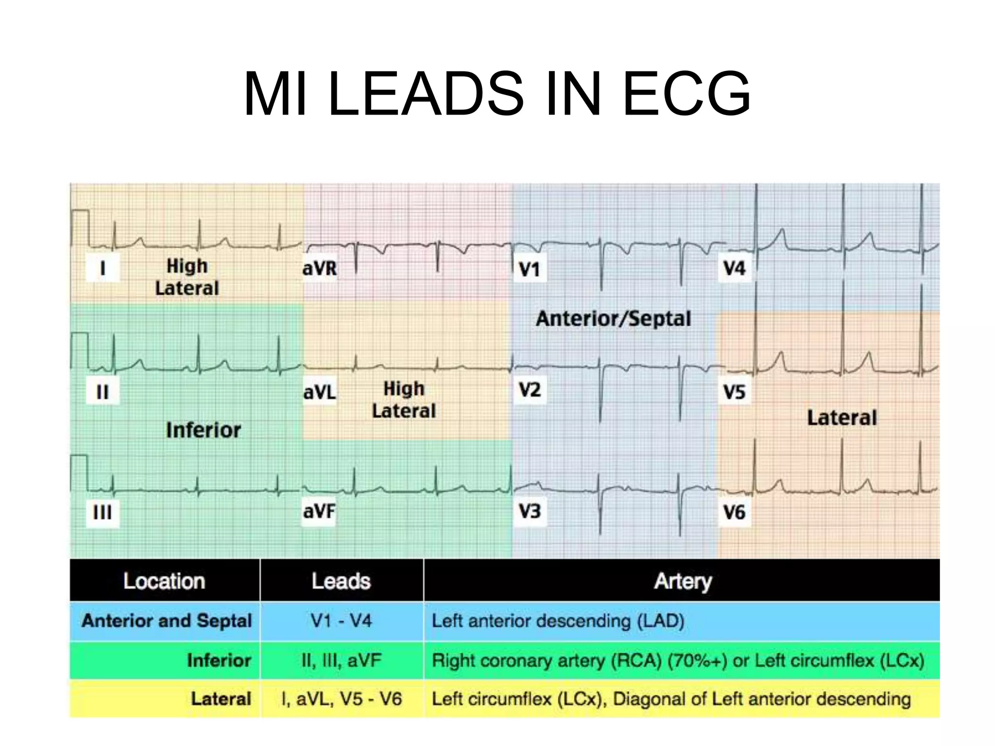 Ecg basics | PPT