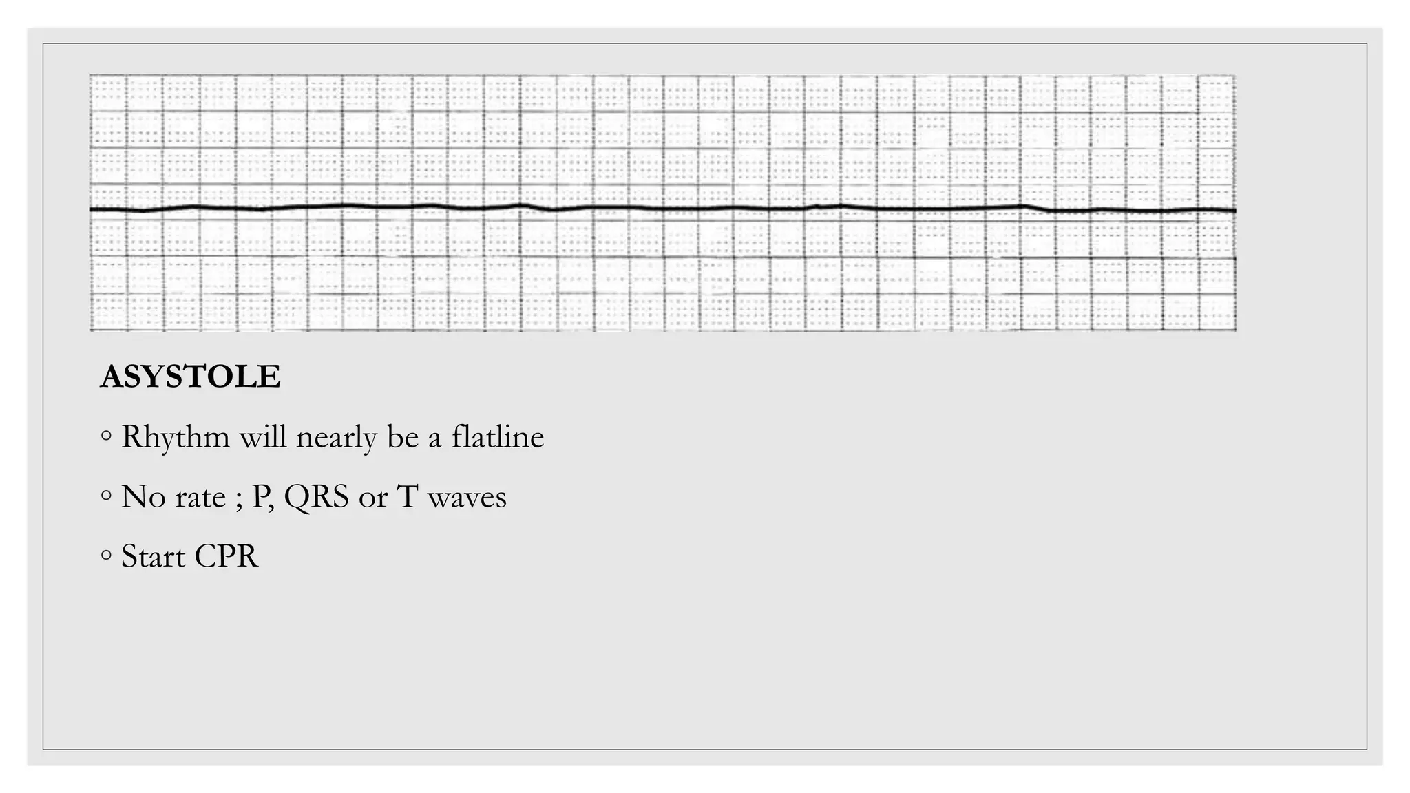 ECG BASICS.pptx