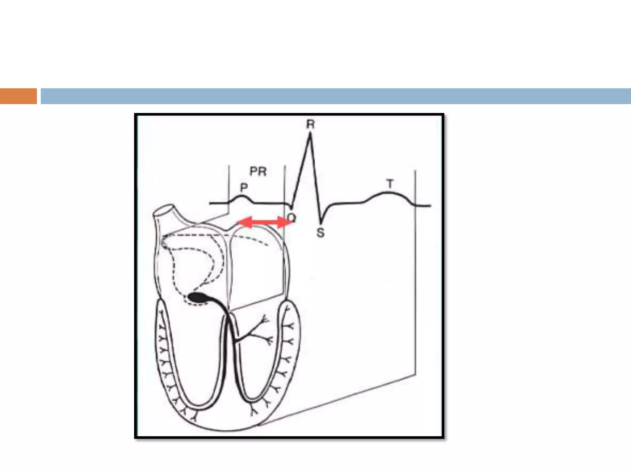 ECG basics.ppt | Heart and Cardiovascular Diseases | Diseases and ...