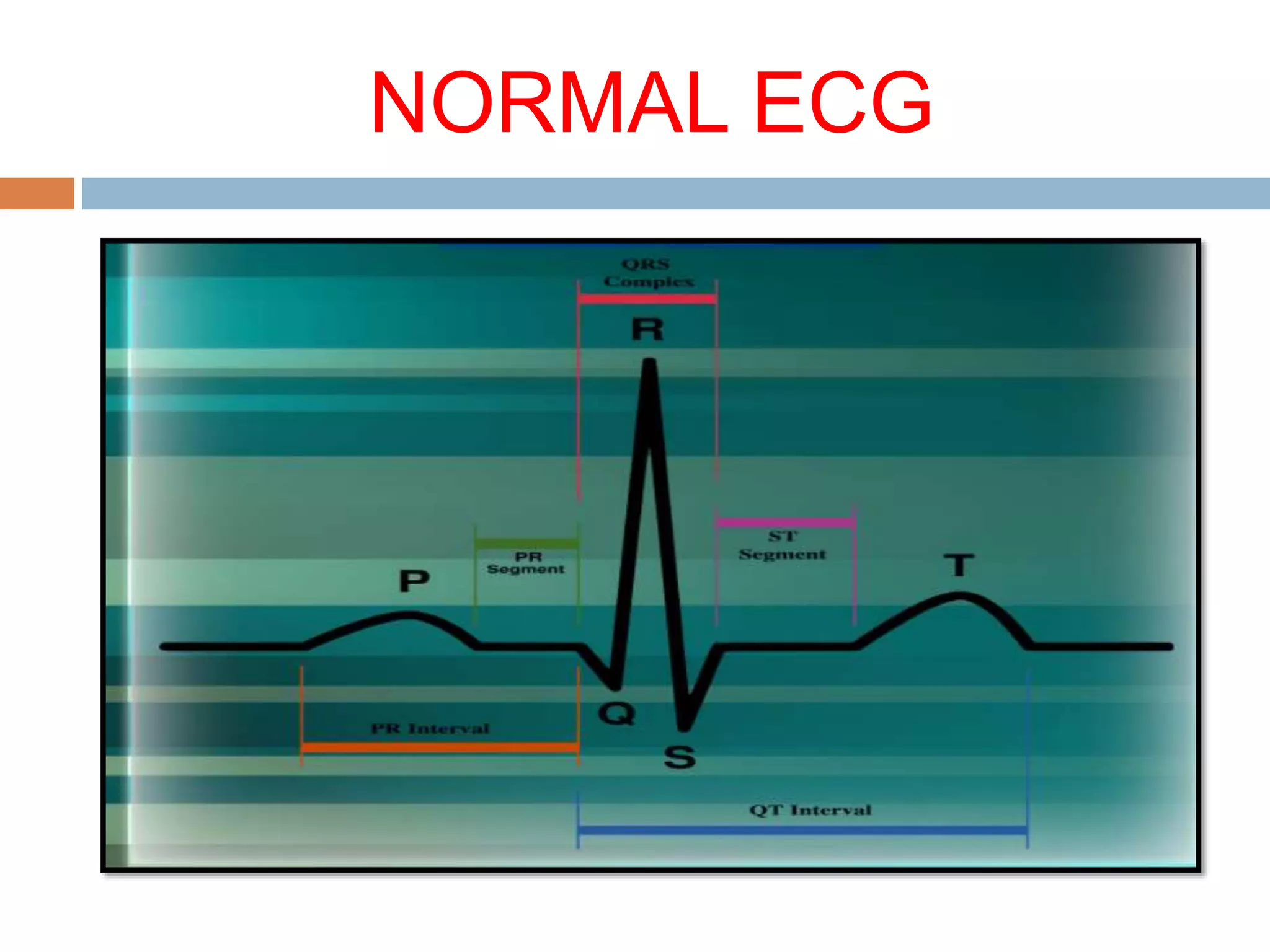 ECG basics.ppt