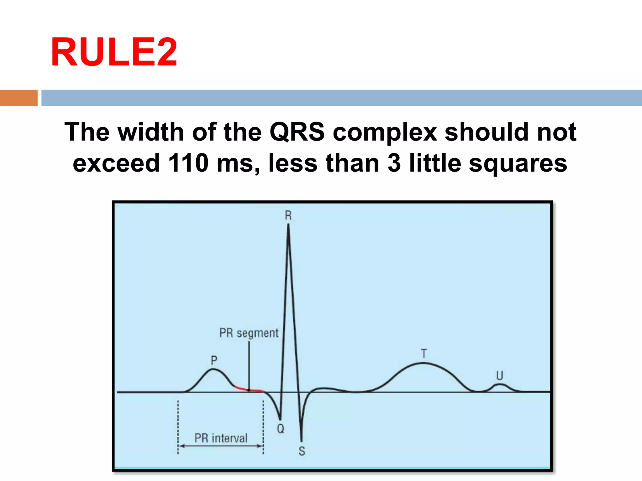 ECG basics.ppt | Heart and Cardiovascular Diseases | Diseases and ...