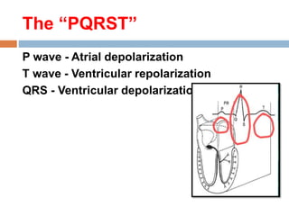 ECG basics.ppt
