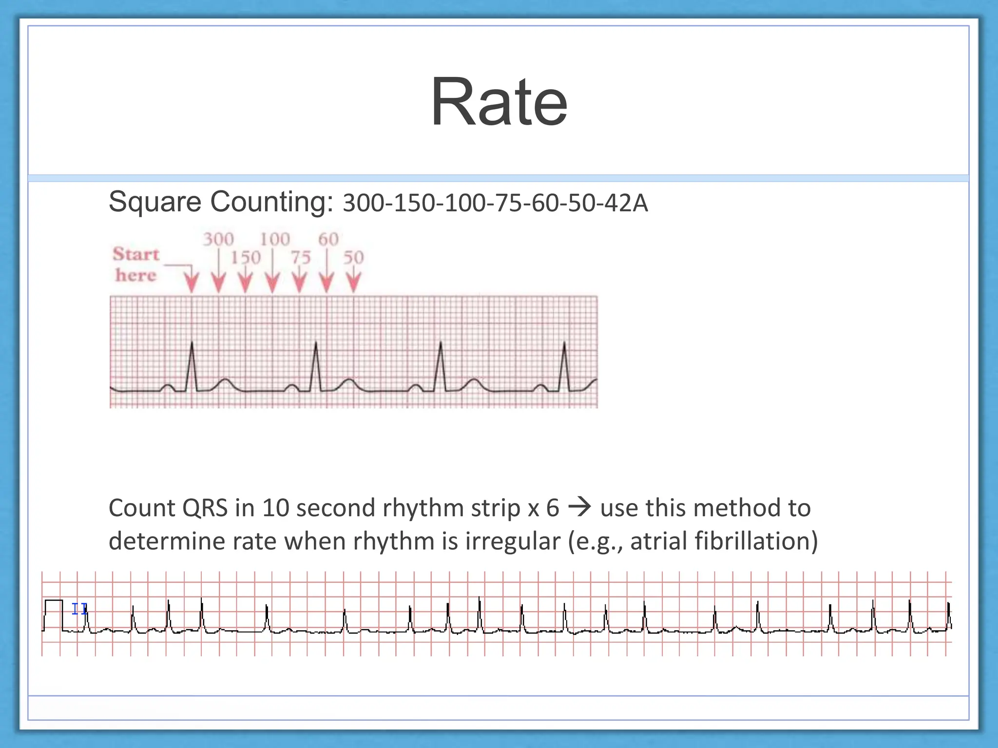 ECG Basics.pptx