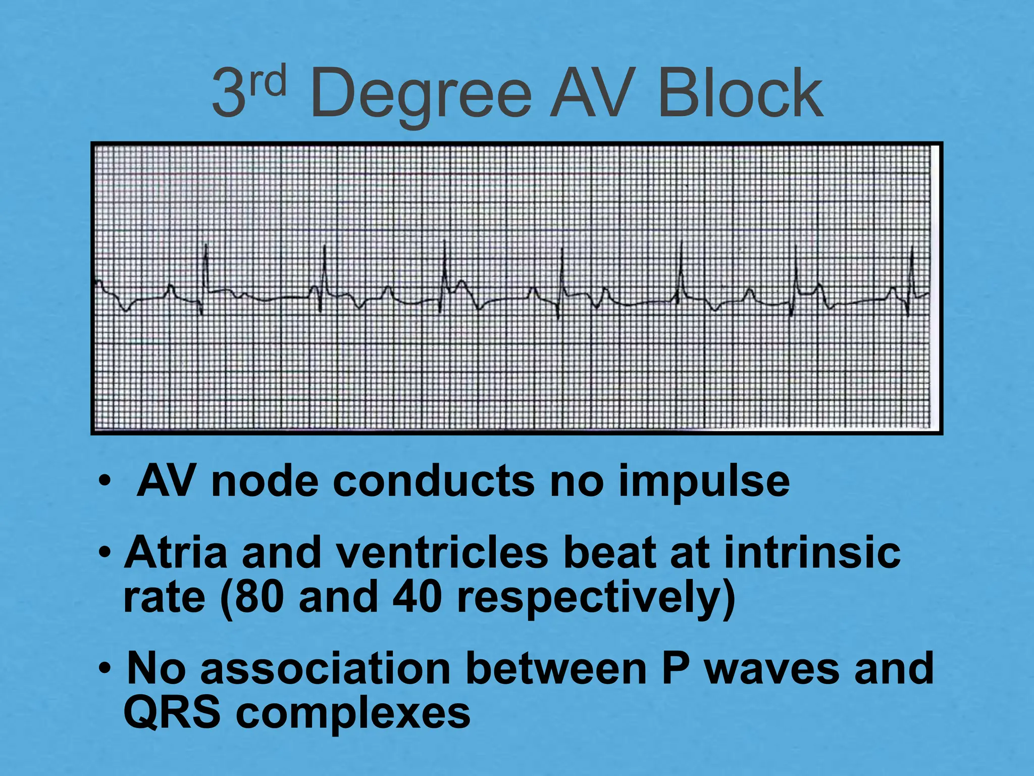 ECG Basics.pptx