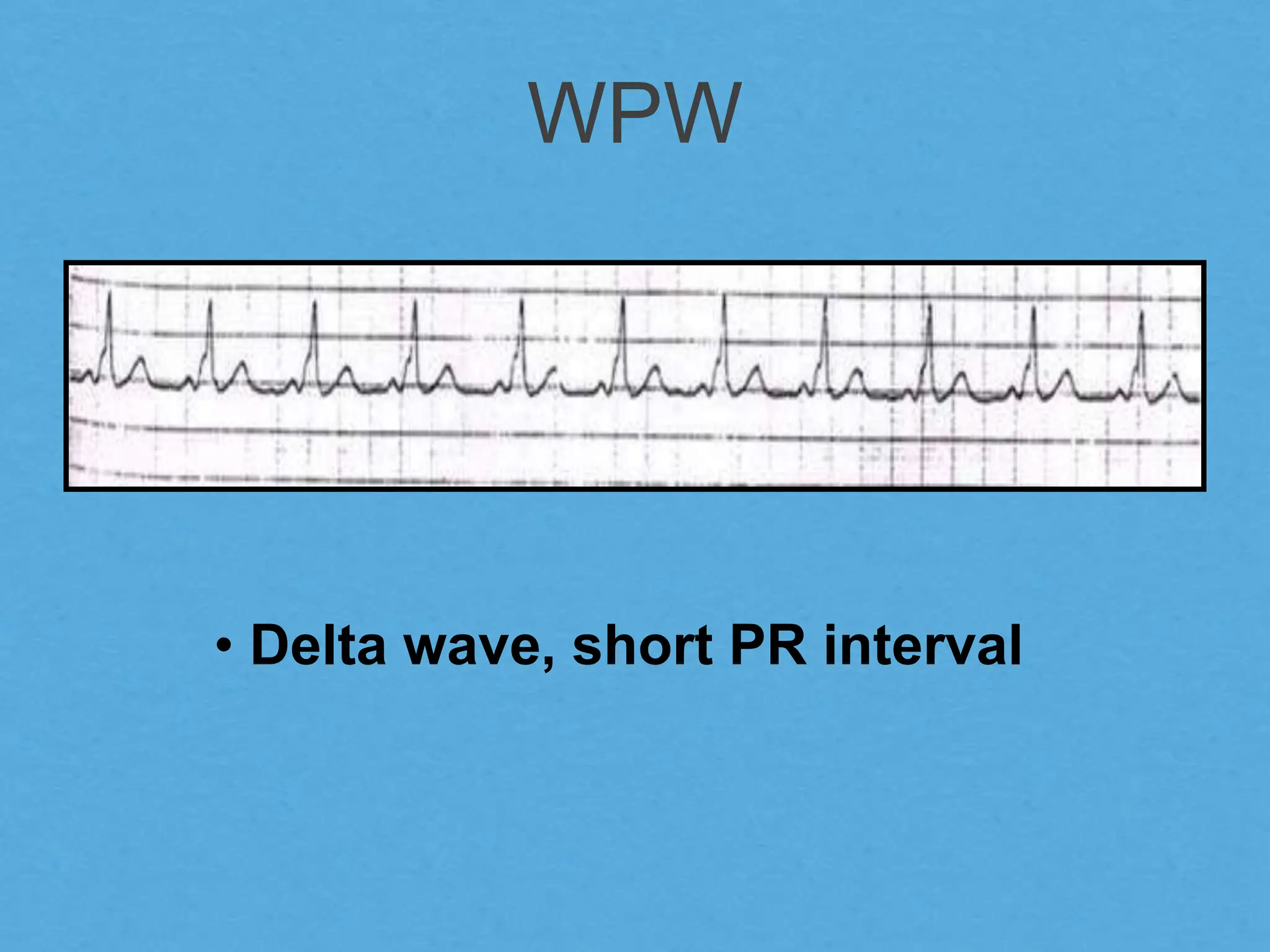 ECG Basics.pptx