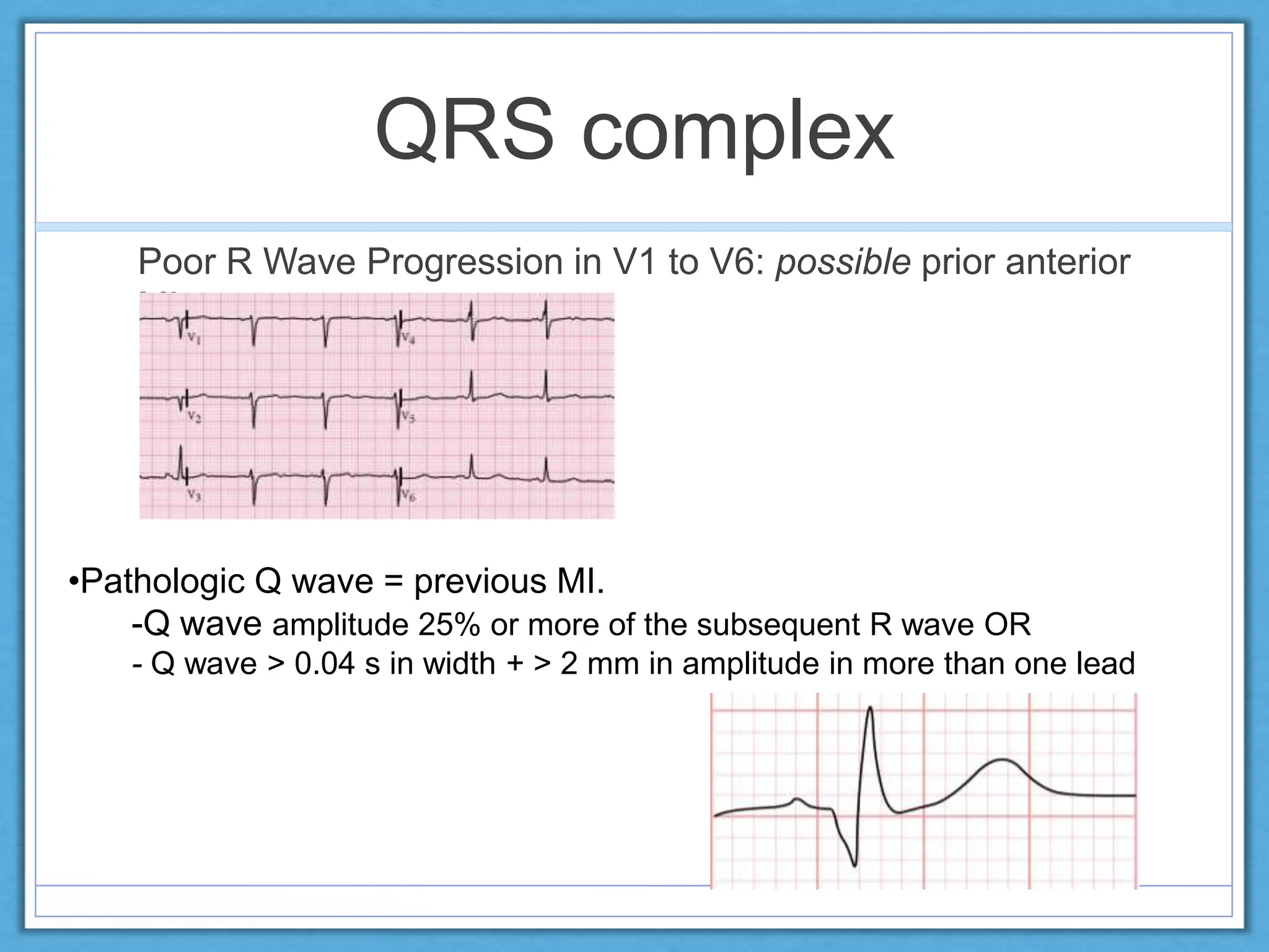 ECG Basics.pptx